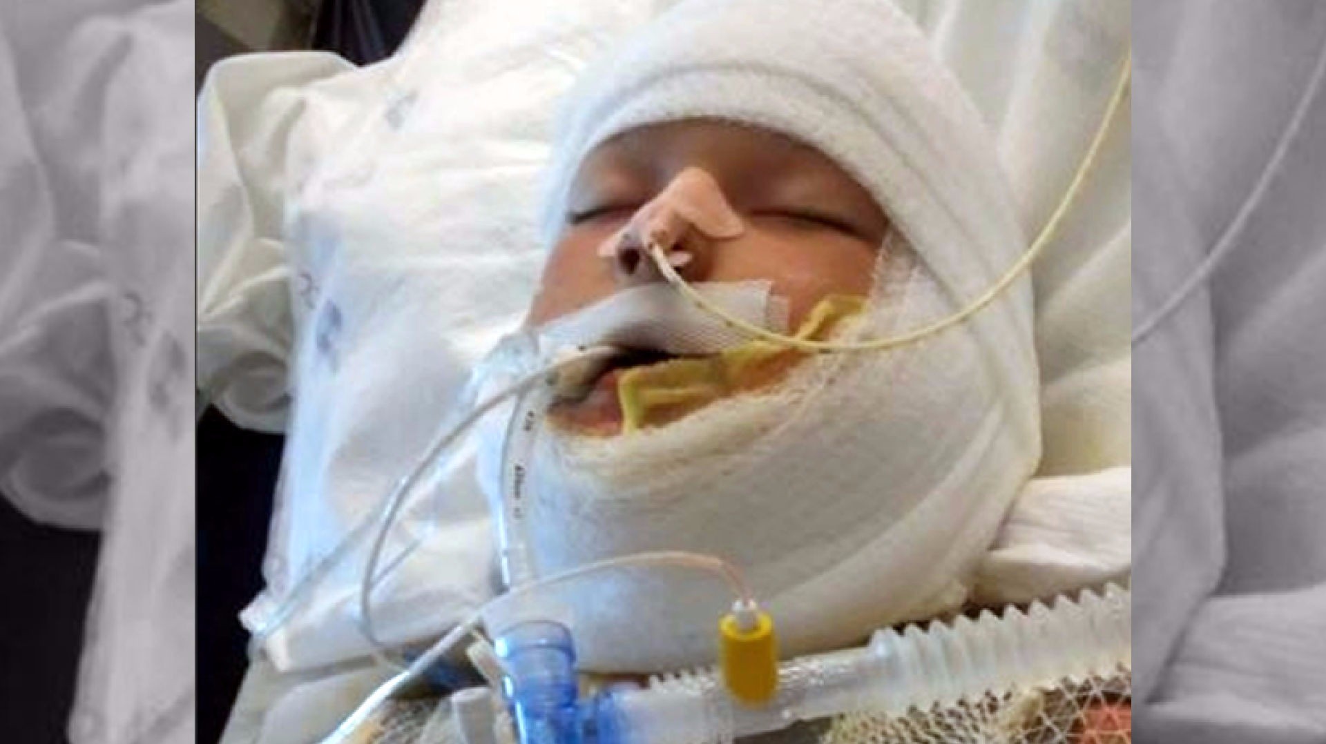 Texas boy set on fire by other children | 9news.com